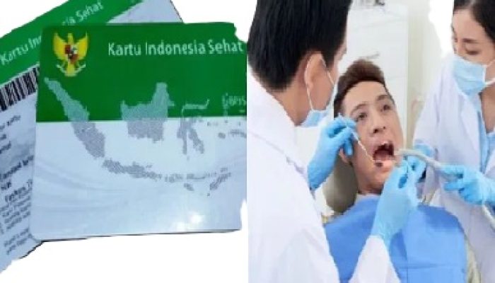Pembuatan Gigi Palsu Melalui BPJS Kesehatan, Ini Syarat dan Prosedurnya! - Warta Saburai